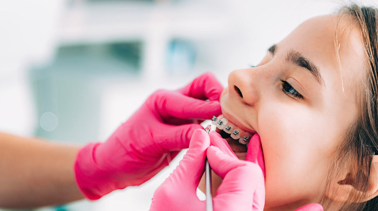 Jugendliche | Kieferorthopädie Praxis in Konstanz am Bodensee